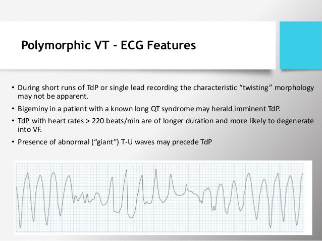 Tachy Arrhythmias - Approach to Management