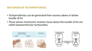 TACHYARRHYTHMIAS mechanism powerpoint .pptx