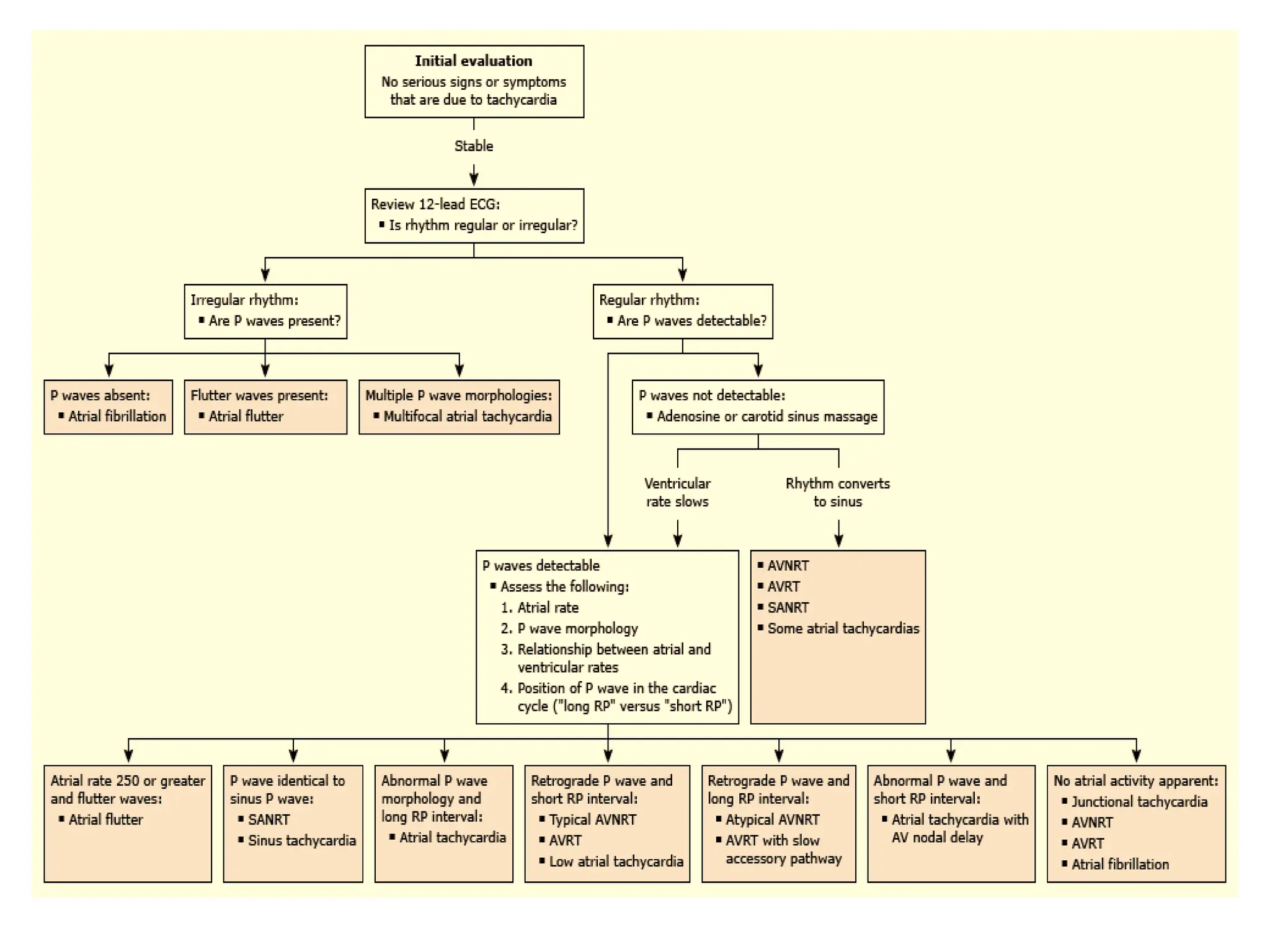 TACHYCARDIA IN ECG ,CAUSES AND MANAGEMENT OF TACHYARRHYTHMIAS | PPTX
