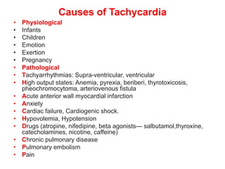 TACHYCARDIA IN ECG ,CAUSES AND MANAGEMENT OF TACHYARRHYTHMIAS | PPTX