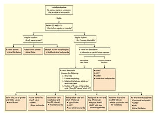 TACHYCARDIA IN ECG ,CAUSES AND MANAGEMENT OF TACHYARRHYTHMIAS | PPTX