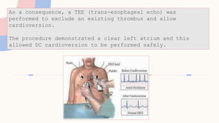 Tachyarrhythmia Case Based Group Discussion.pptx