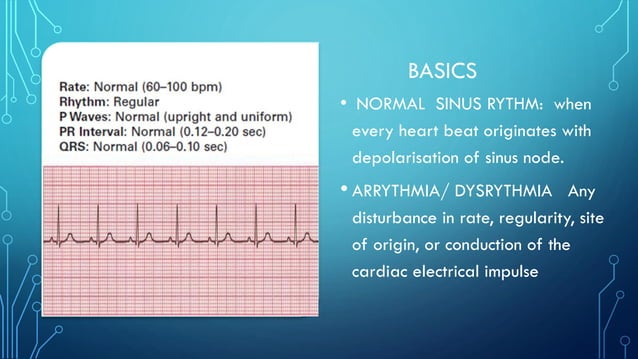 TACHY ARRYTHMIAS | PDF | Heart and Cardiovascular Diseases | Diseases ...