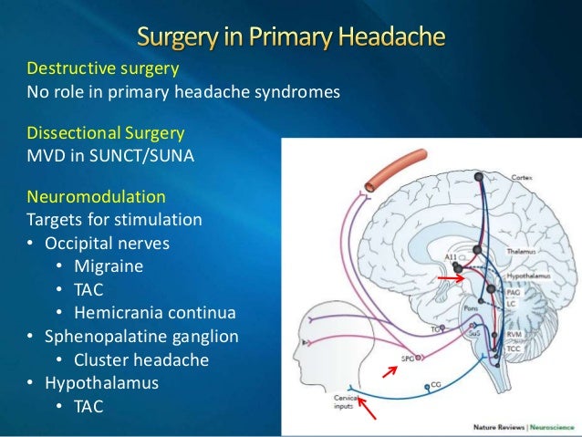 Dr Manjit Matharu - Rare TACS/Neurostimulation