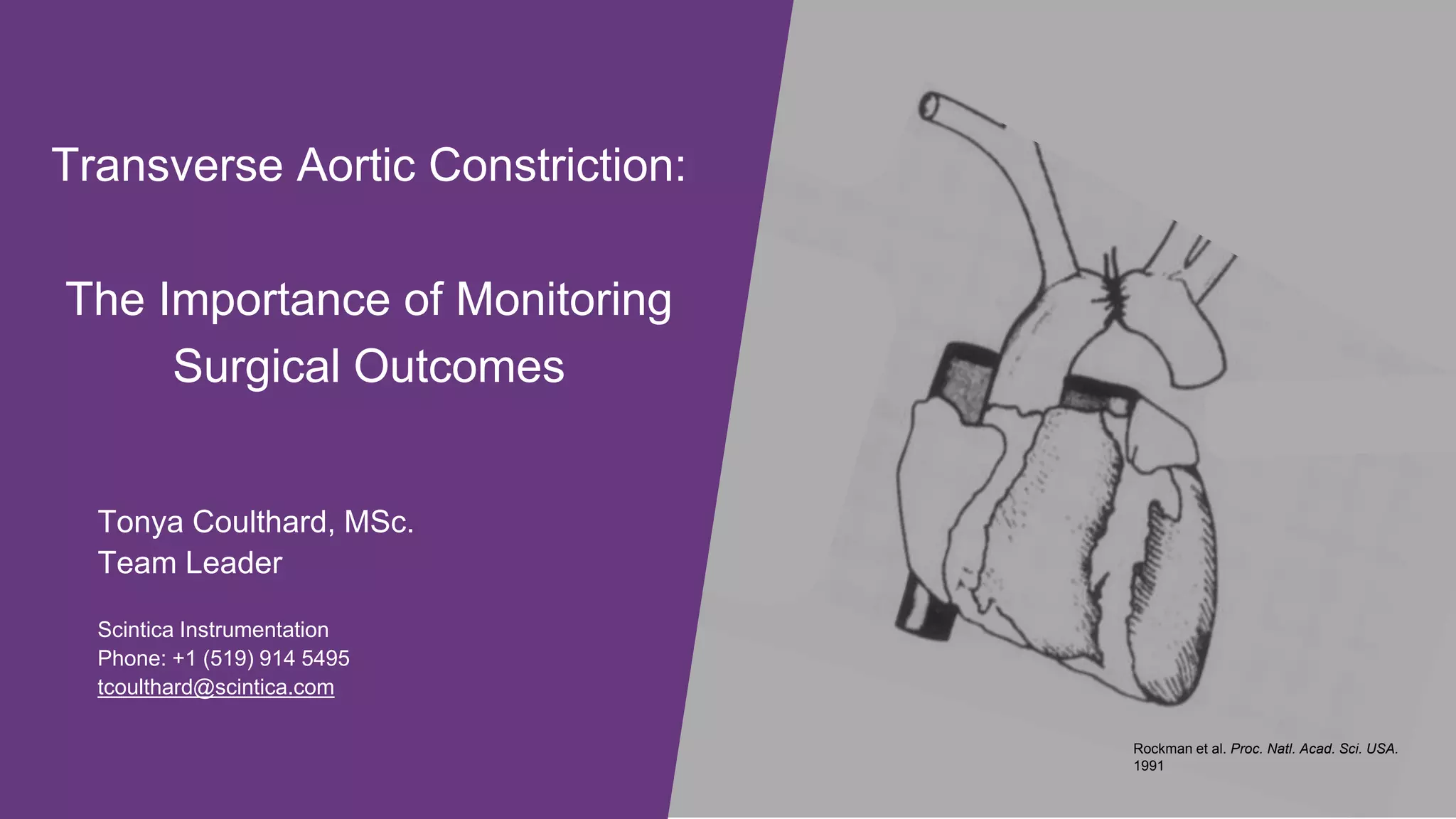 Transverse Aortic Constriction: The Importance of Monitoring Surgical ...