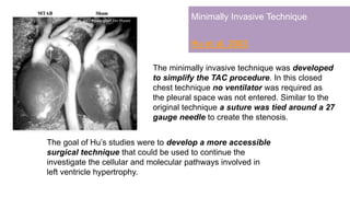 Transverse Aortic Constriction: The Importance of Monitoring Surgical ...