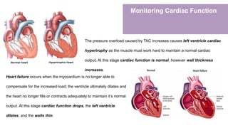 Transverse Aortic Constriction: The Importance of Monitoring Surgical ...