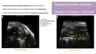 Transverse Aortic Constriction: The Importance of Monitoring Surgical ...