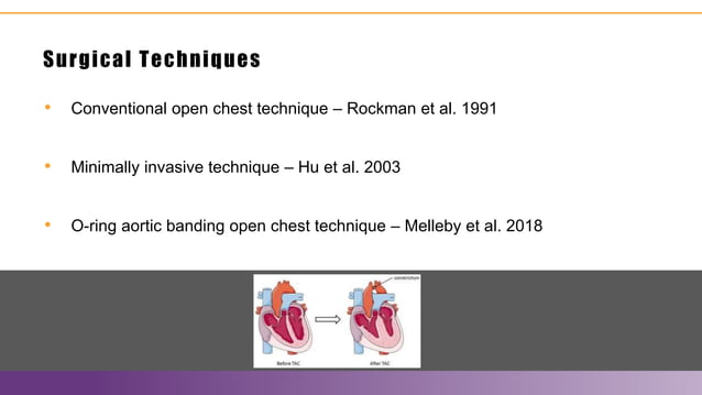 Transverse Aortic Constriction: The Importance of Monitoring Surgical ...