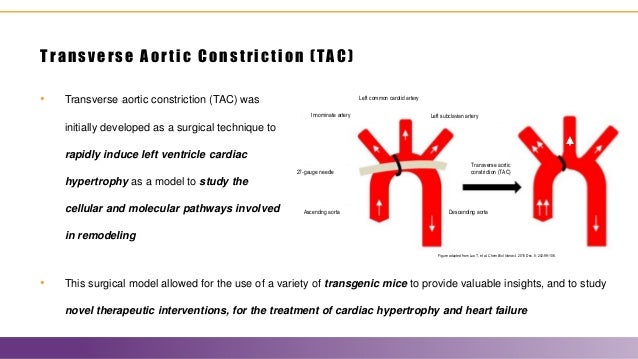 Transverse Aortic Constriction: The Importance of Monitoring Surgical…