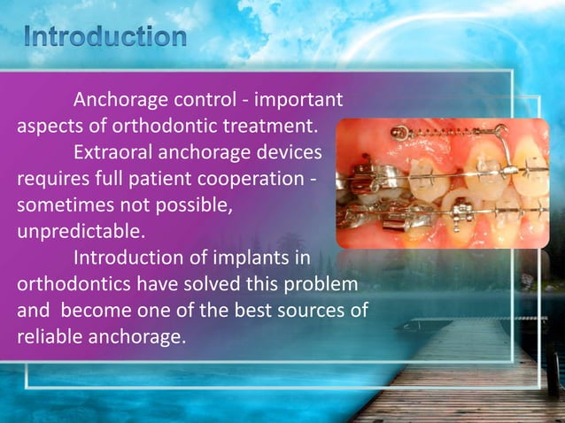 Temporary Anchorage Devices (TADs) | PPTX | Dental Health | Diseases ...