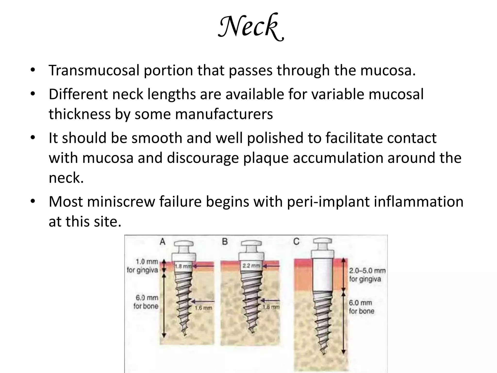 Temporary anchorage devices in orthodontics | PPTX