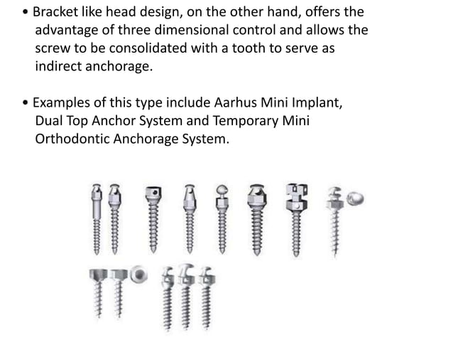 Temporary anchorage devices in orthodontics | PPTX