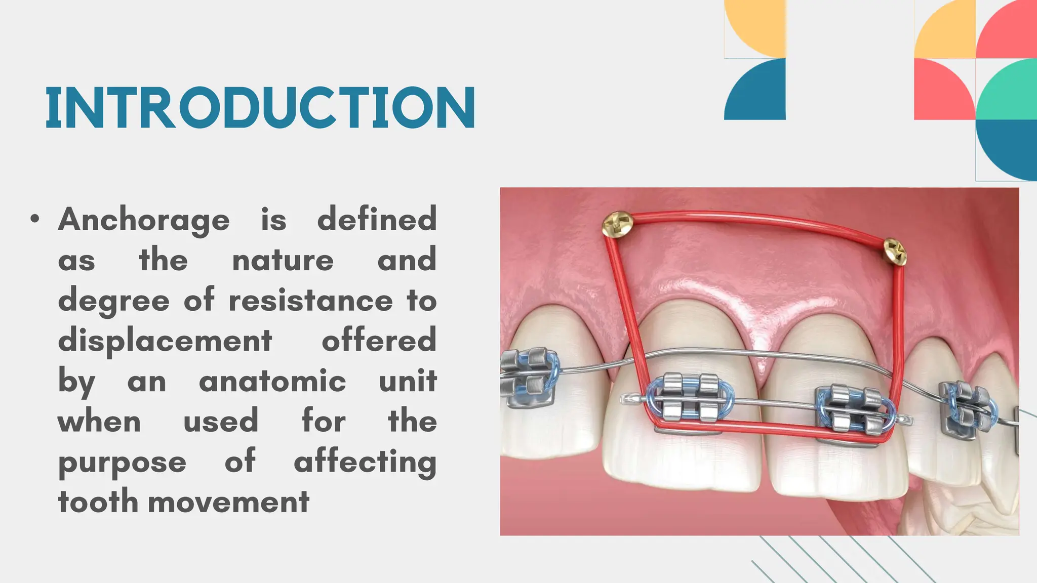 Temporary anchorage devices (TADs) .pptx
