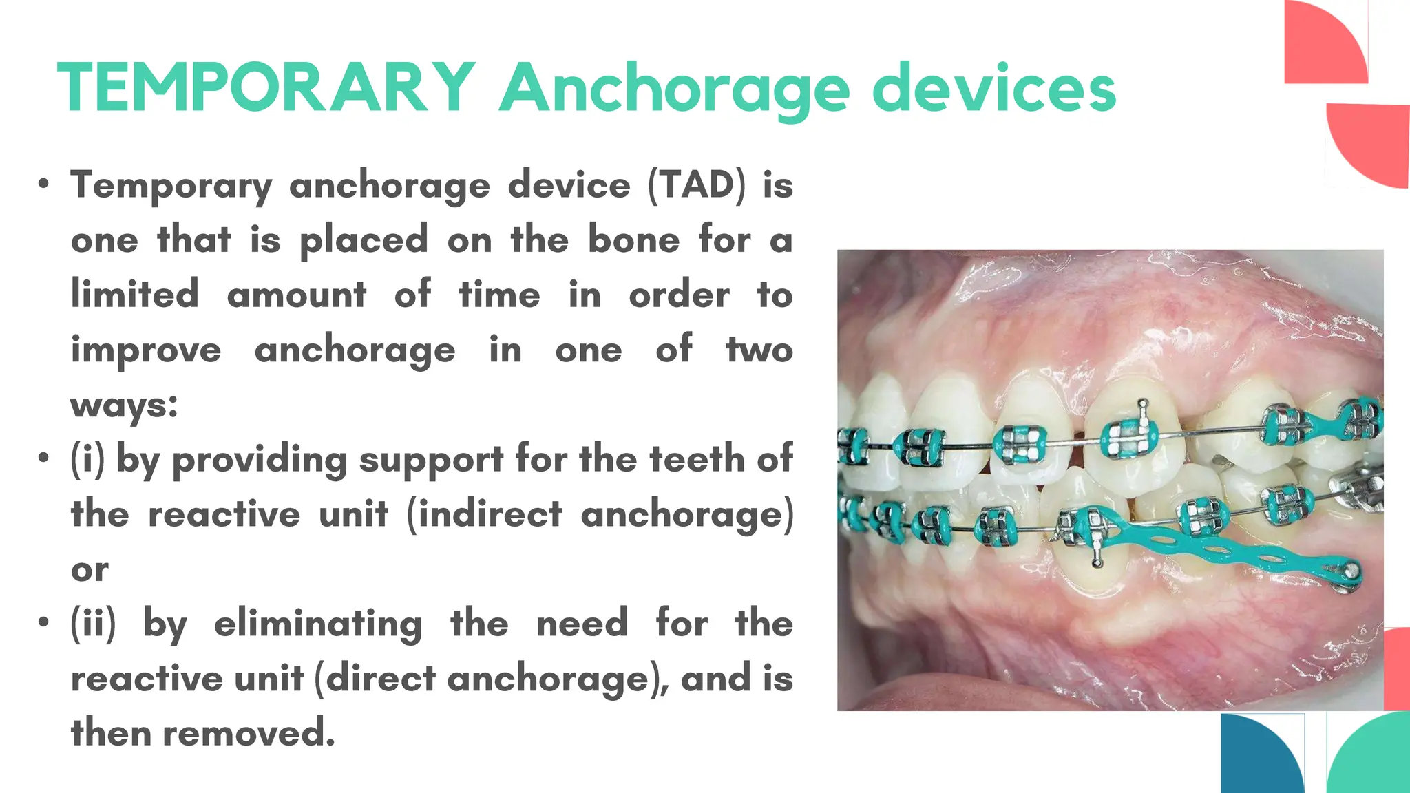 Temporary anchorage devices (TADs) .pptx