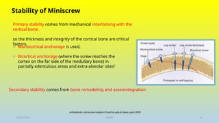 Temporary Anchorage Devices (TADS) Miniscrew | PPTX