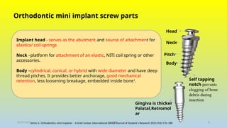 Temporary Anchorage Devices (TADS) Miniscrew | PPTX
