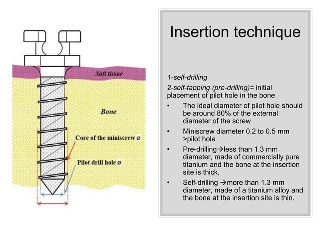 Temporary Anchorage Devices | PDF