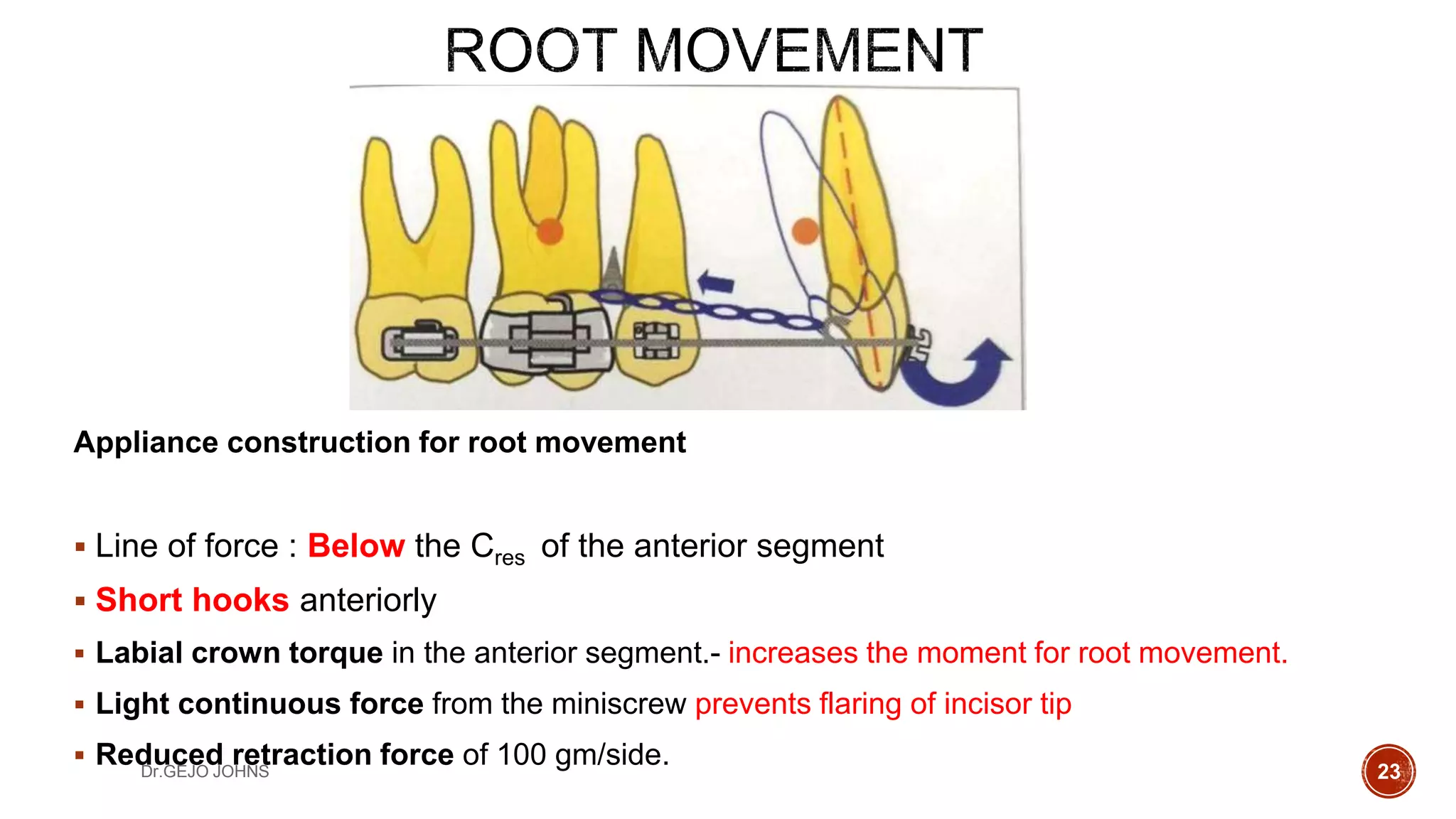 Bio-mechanics of TADS | PPTX