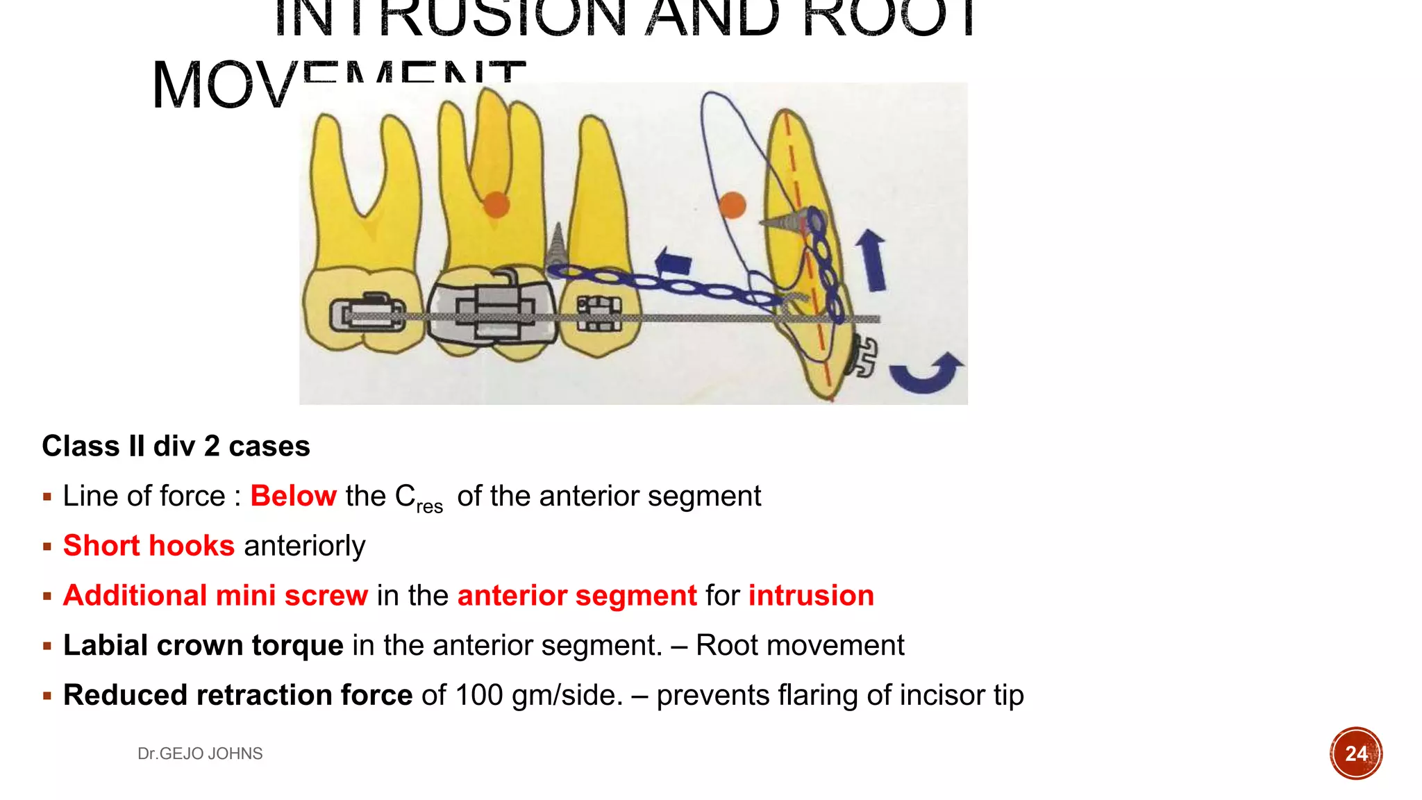 Bio-mechanics of TADS | PPTX