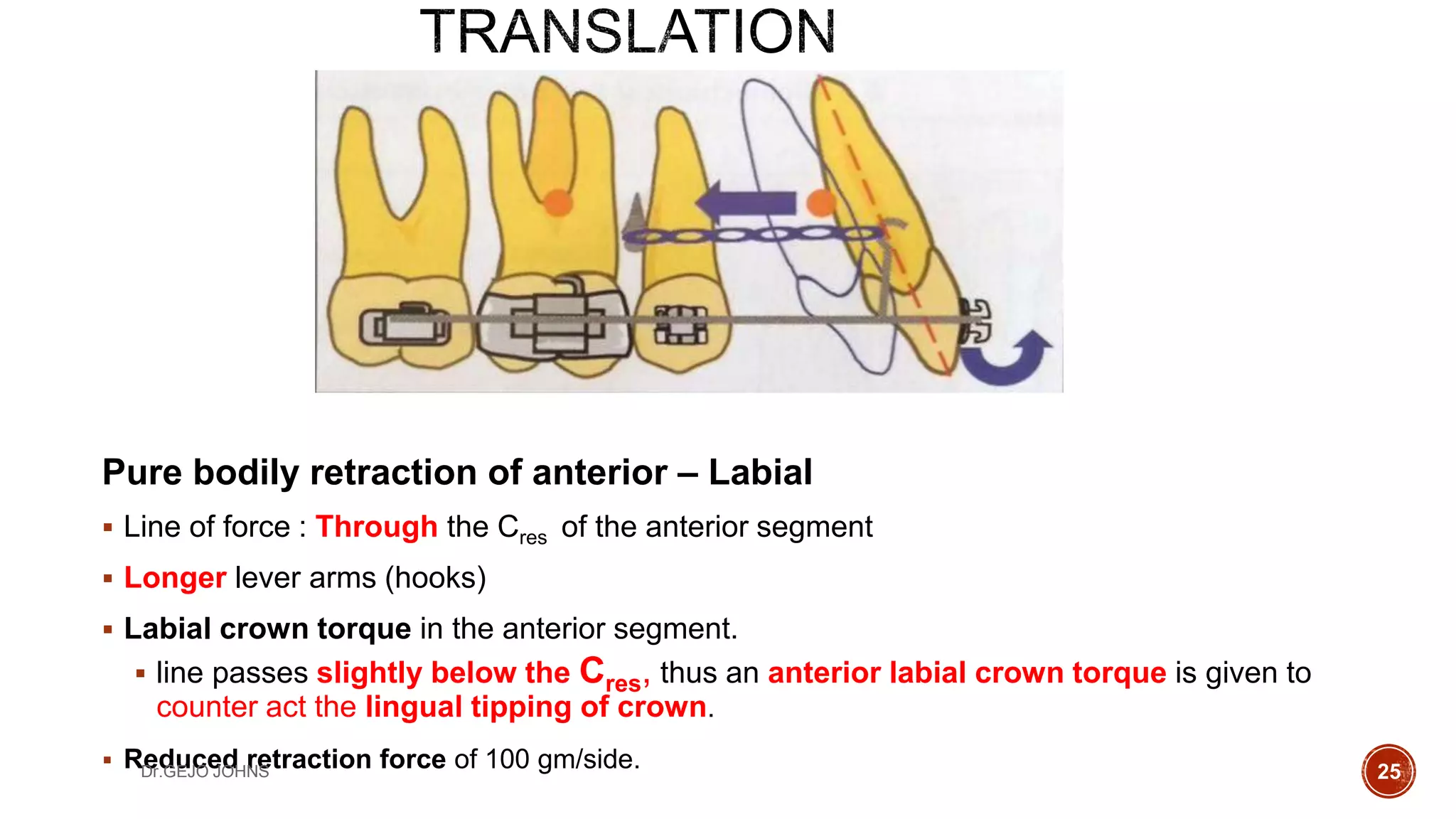 Bio-mechanics of TADS | PPTX