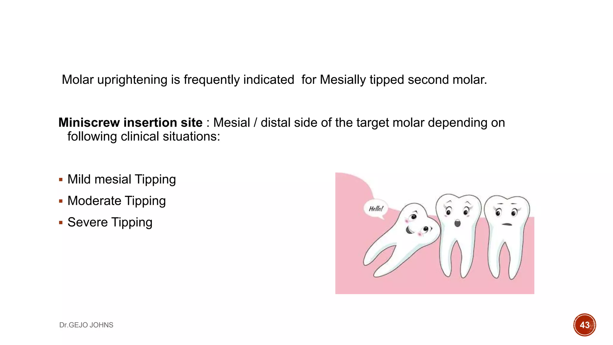 Bio-mechanics of TADS | PPTX