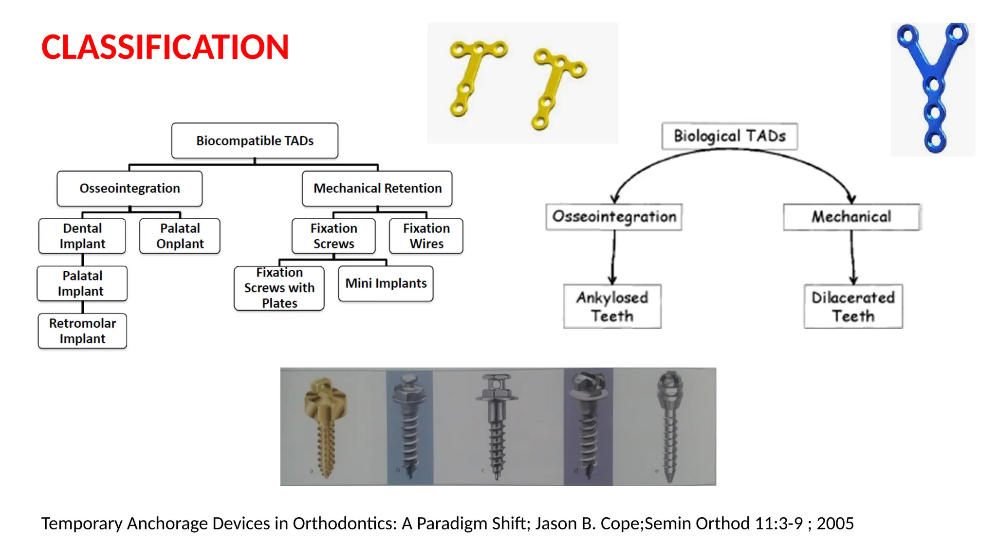 TADS Temporary anchorage devices PEDAGOGY.pptx