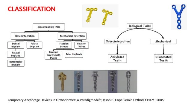 TADS Temporary anchorage devices PEDAGOGY.pptx