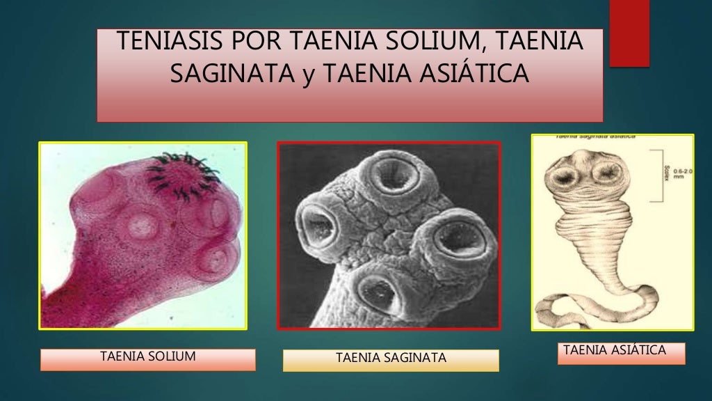 TENIASIS POR TAENIA SOLIUM, TAENIA SAGINATA y TAENIA ASIÁTICA