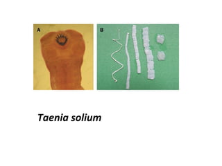 Taenia infection zoonoses | PPT