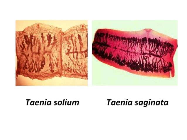 Taenia infection zoonoses | PPT