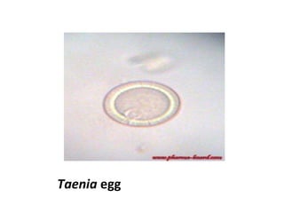 Taenia infection zoonoses | PPT