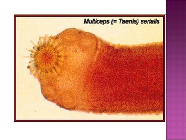 Taenia multiceps