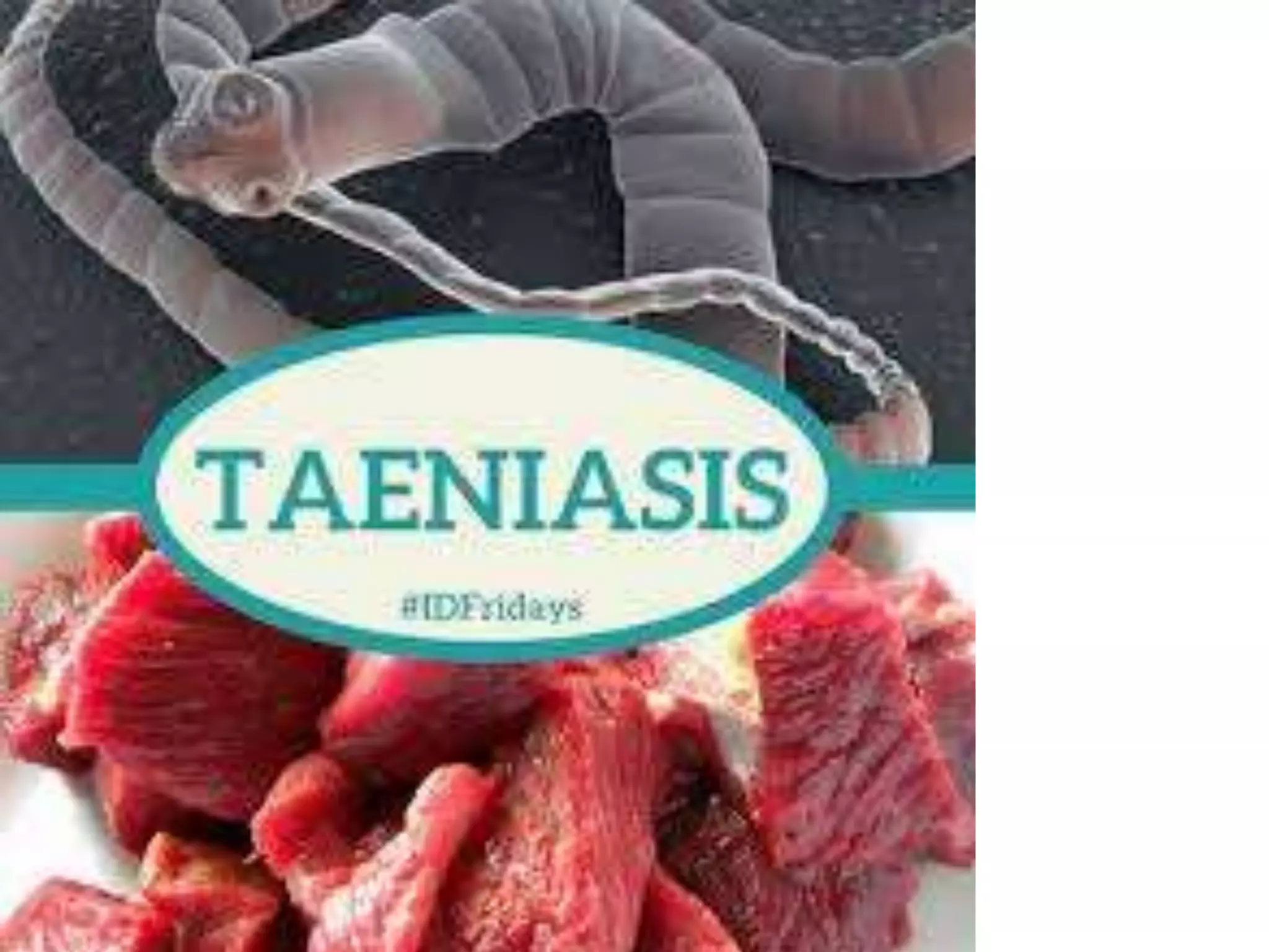 Taeniasis | PPT