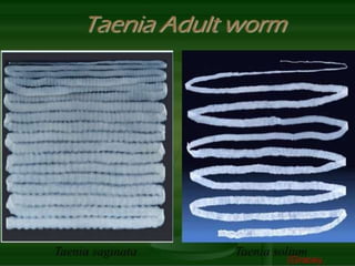 Taeniasis | PPTX | Infectious Diseases | Diseases and Conditions