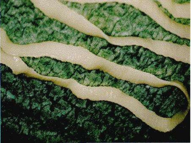 Taeniasis | PPT | Digestive Disorders | Diseases and Conditions