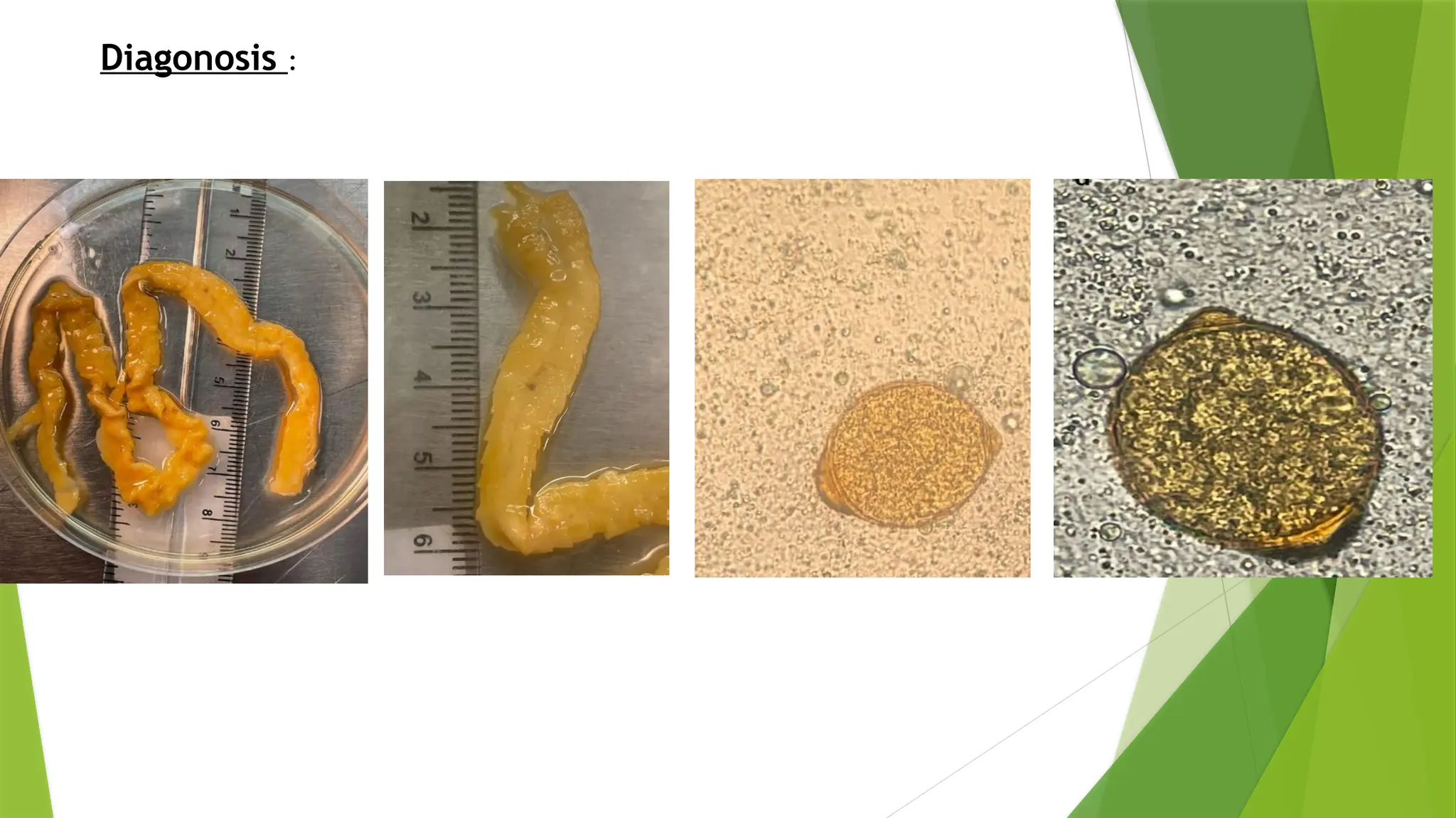 taenia solium(pork tapeworm)- Morphology|Lifecycle|Symptoms |Diagnosis ...