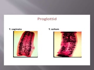 Taenia Saginata Proglottids