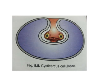 Taenia Saginata Cysticercus Bovis