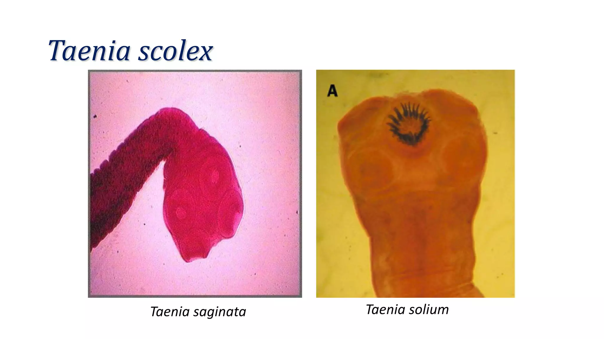 Taenia solium & Taenia saginata | PPTX