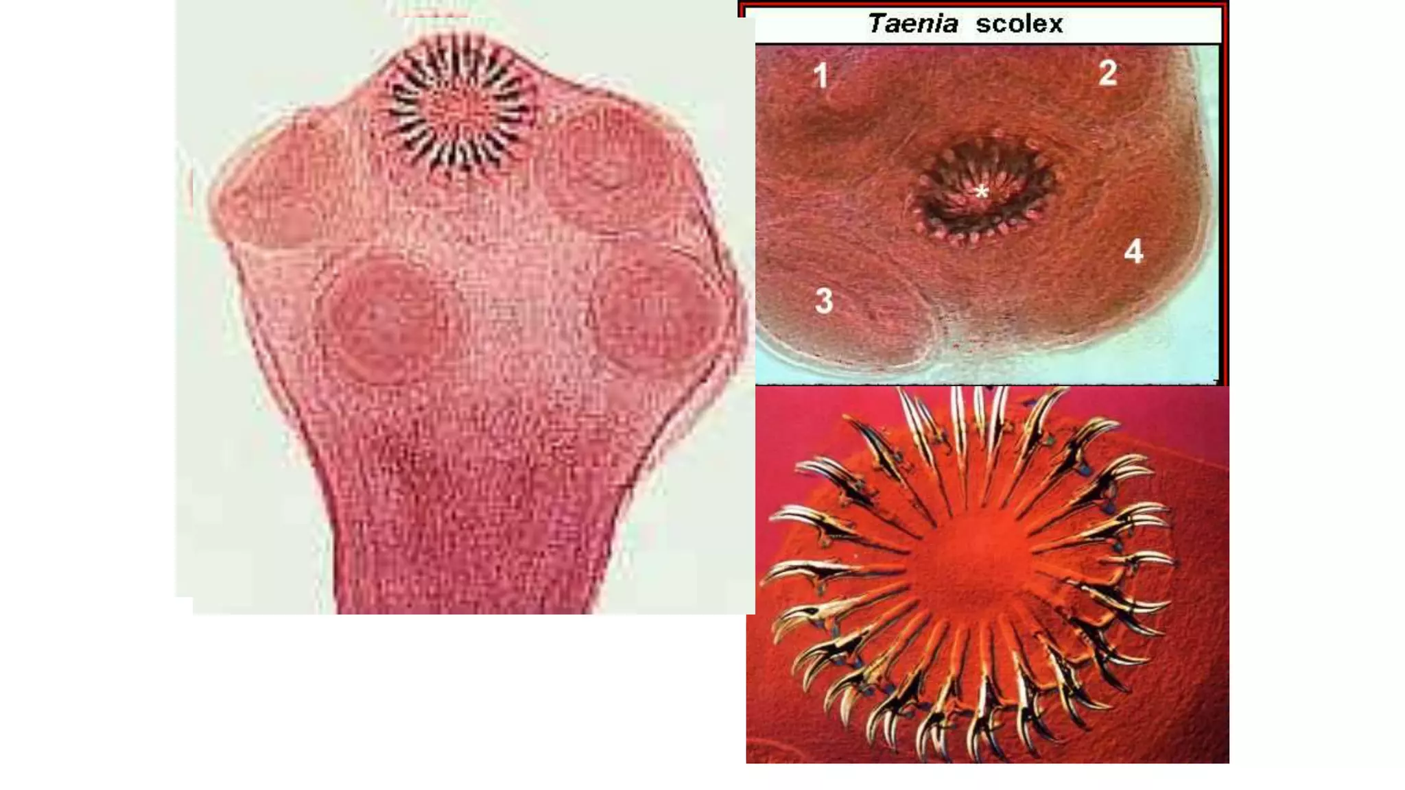 Taenia solium & Taenia saginata | PPTX