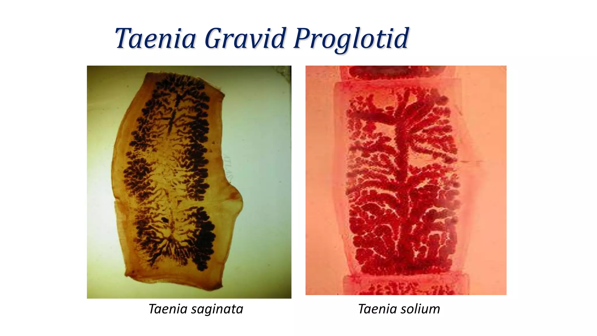 Taenia solium & Taenia saginata | PPTX