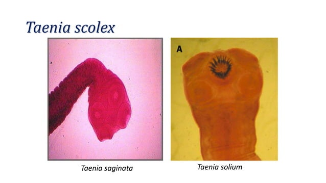 Taenia solium & Taenia saginata | PPTX