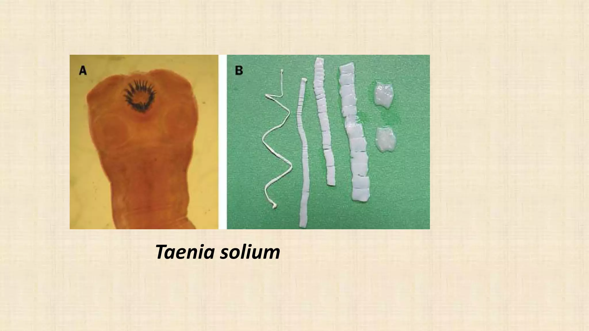 Taenia spp.. | PPTX