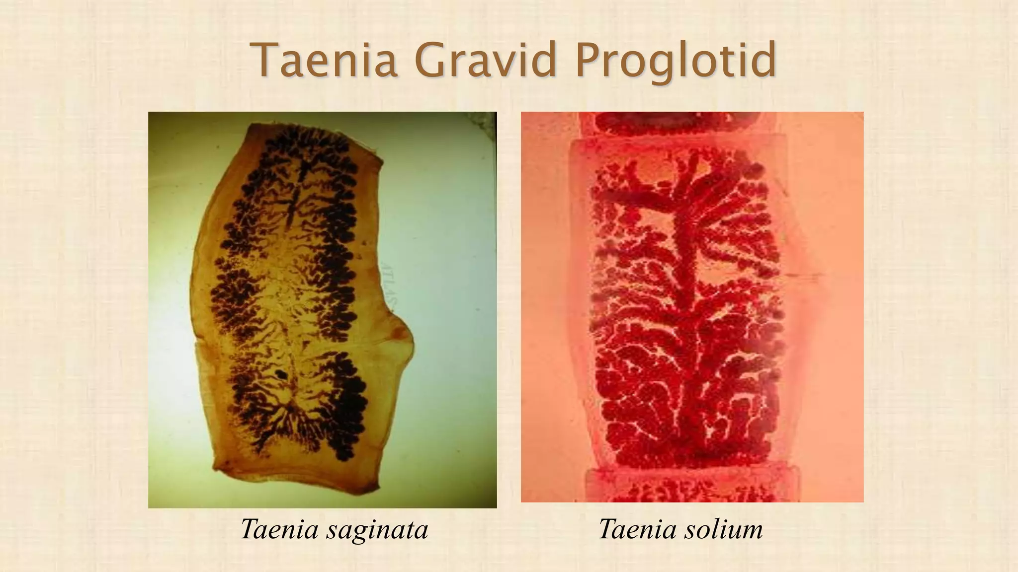 Taenia spp.. | PPTX
