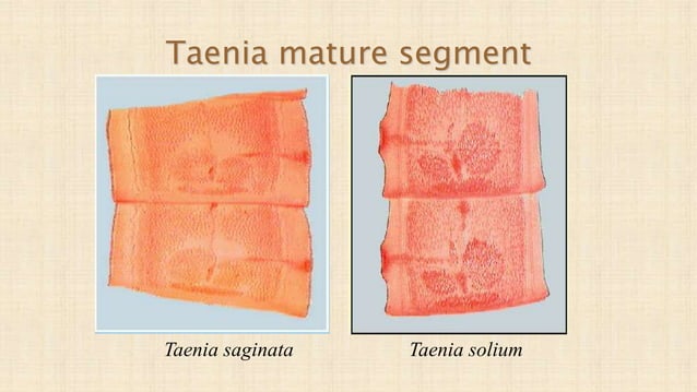 Taenia spp.. | PPTX | Digestive Disorders | Diseases and Conditions