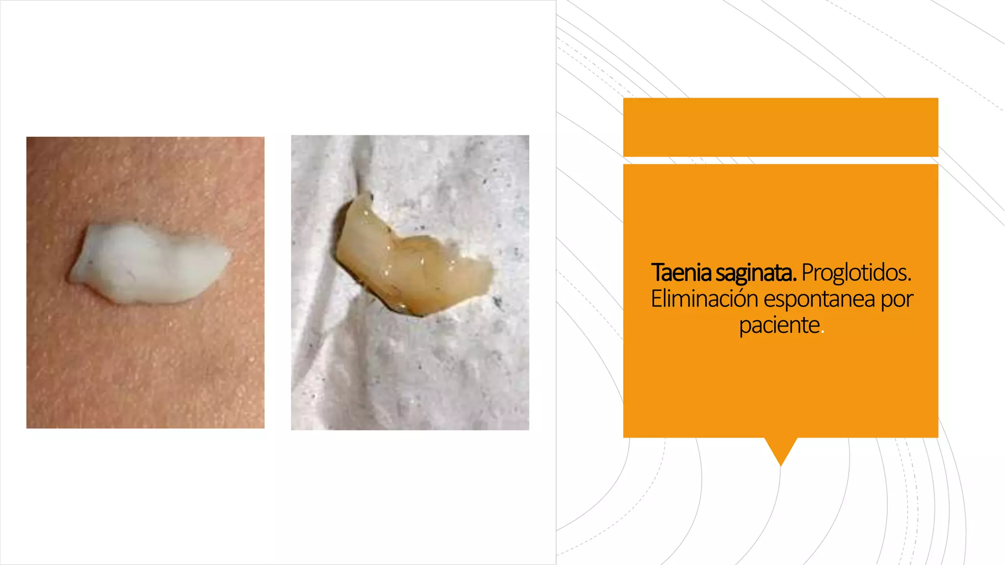 TAENIOSIS Y CISTICERCOSIS. Taenia saginata y Taenia solium. | PPT