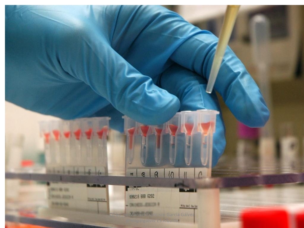 Inmunohematología
