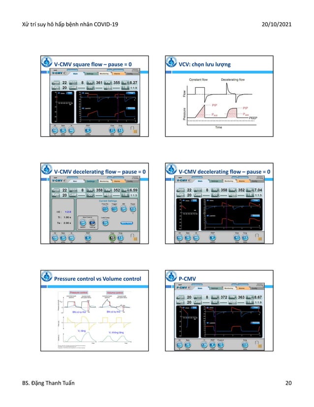 Tai lieu Ho tro ho hap cho benh nhan COVID-19.pdf
