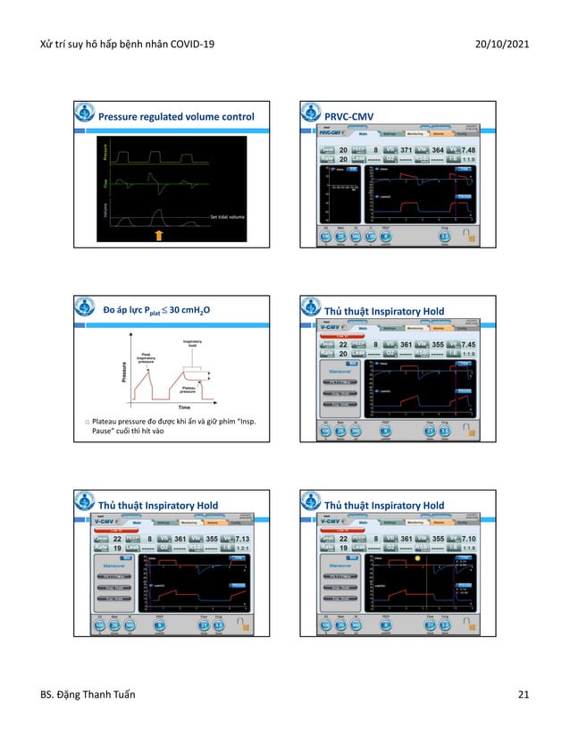 Tai lieu Ho tro ho hap cho benh nhan COVID-19.pdf